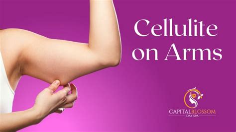 All You Need To Know About Cellulite On Arms Capital Blossom Day Spa