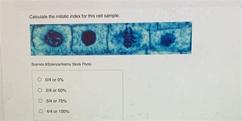[solved] Calculate The Mitotic Index For This Cell Sample Scenics