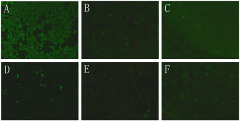 Indirect Immunofluorescence Assay Of Autoimmune Encephalitis Download Scientific Diagram