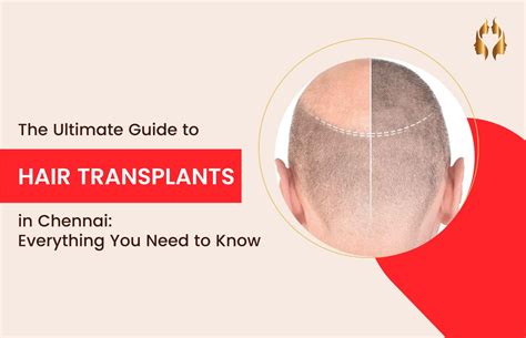 Circumcision Surgery In Chennai Rajcosmetic Surgery