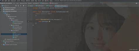 注解Annotation 常用英文注解是什么意思 CSDN博客