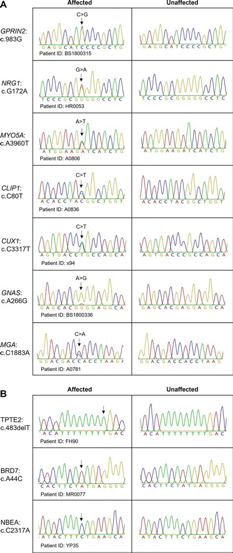 Sanger Sequencing Validation Of Variants Identified By Whole Exome Download Scientific Diagram