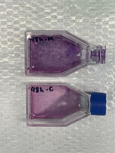 Do You Know What Might Have Happened In The Flask Researchgate