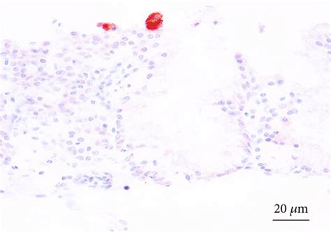 Histology And Immunohistochemical Detection Of Mycoplasma Spp In