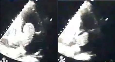 Transthoracic Echocardiography Download Scientific Diagram