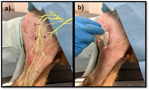 A Schematic Representation Of The Distribution Of The Sciatic Nerve