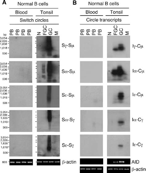 Figure 2 From Ongoing In Vivo Immunoglobulin Class Switch Dna Recombination In Chronic