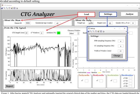 Ctg Analyzer A Graphical User Interface For Cardiotocography