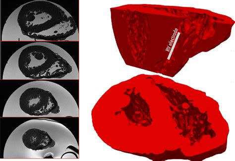 Figure 1 From Human Response To Low Energy Monophasic Shocks Semantic Scholar