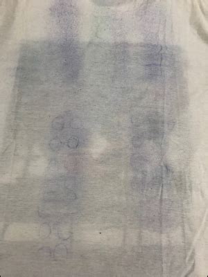 Various Techniques For Marking Patch Test Sites Indian Journal Of Dermatology Venereology And