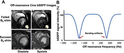 Figure 1 From Reliable Off Resonance Correction In High Field Cardiac