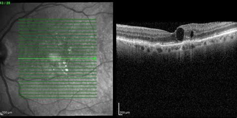 Proj Object Detection Model By Charles Williamson