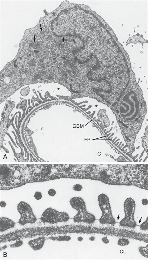 Elements Of Renal Function Clinical Tree