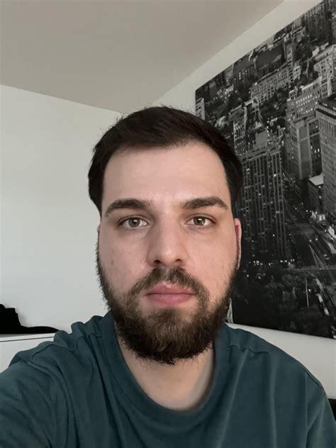 Is It Over For Me R Bald