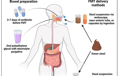 Modifying The Gut Microbiome To Improve Immunotherapy Treatment Response Asco Microbiome