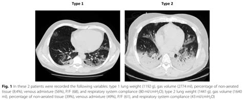 Ards Protocols Simva