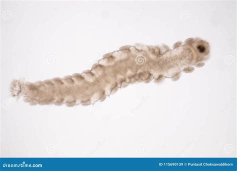 Microscopic Polychaete Or Bristle Worms Under Microscope View Stock