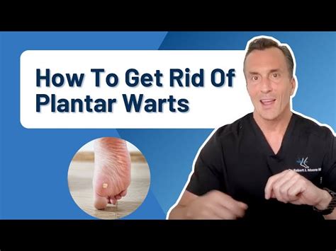 Plantar Wart Root Removal
