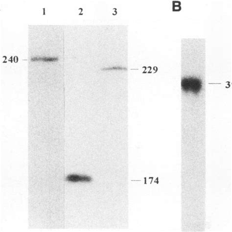 Northern Blot Analysis Of Processing At The 18s Rrnaits 1 Junction For