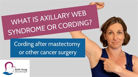What Is Axillary Web Syndrome Or Cording What Is Axillary Web Syndrome Or Cording