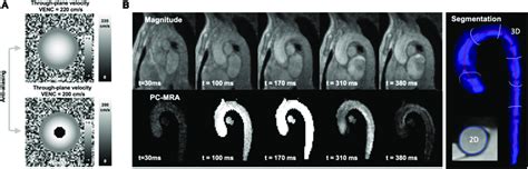 A Simulated Parabolic Flow With A Central Peak Velocity Of 220 Cm S