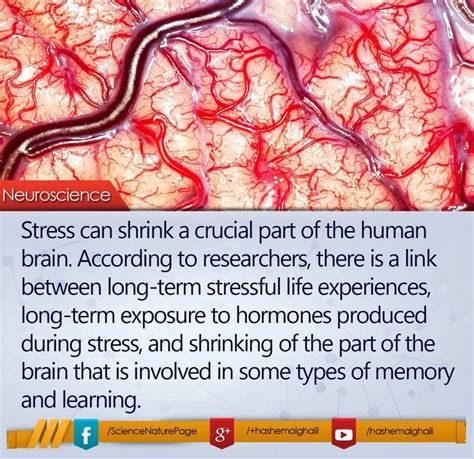 Stress Shrinks The Human Brain So Prevalent In Todays Day And Age We