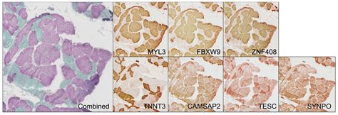 Multiplex Ihc On The Same Tissue Section Identifies Co Registration Of Download Scientific