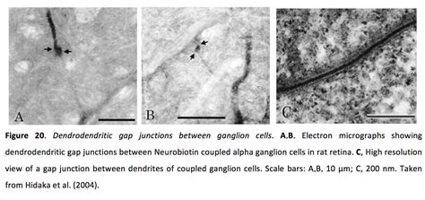 Gap Junction Electron Micrograph