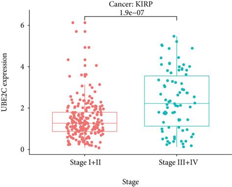 Clinical Stage Analysis Of Ube2c The High Ube2c Expression Level Meant
