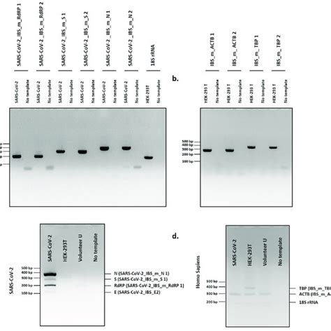 Optimization And Development Of A Multiplex Pcr Protocol For Sars Cov 2 Download Scientific