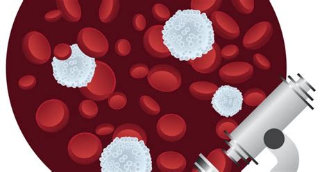 Eritrocite scăzute la copil Cauze simptome și tratament Qbebe ro