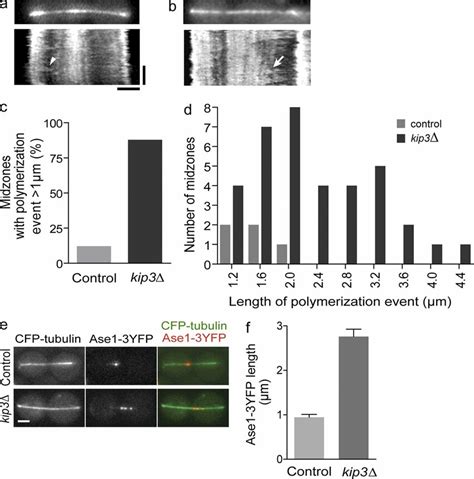 Kip3 Suppresses Spindle Microtubule Dynamics And Limits Midzone Length Download Scientific