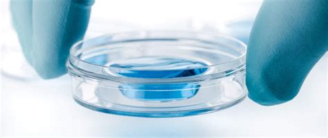 Quality Management System On The In Vitro Diagnostics Industry