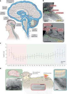 Endocisternal Interfaces For Minimally Invasive Neural Stimulation And