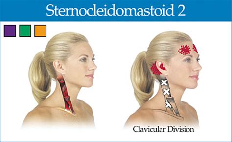 SCM Trigger Point Orleans Core Elements