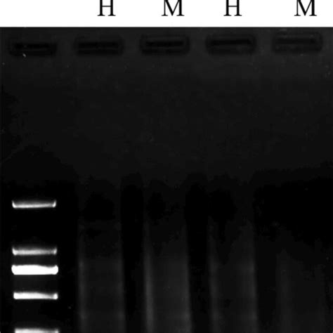 Electropherogram Of Selective Amplification H Ecori Hpaii