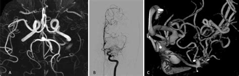 Case 1 A Mr Angiography Shows Left Mca Occlusion B Conventional Download Scientific Diagram