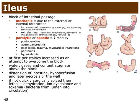 Ppt Pathophysiology Of Git I Powerpoint Presentation Free Download