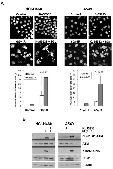 Induction Of Multinucleated Cells After The Treatment With Ku55933 A