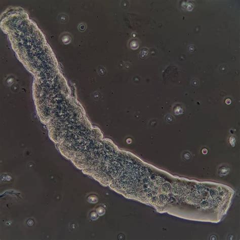 Labclinico 𝗖𝗜𝗟𝗜𝗡𝗗𝗥𝗢𝗦 𝗖É𝗥𝗘𝗢𝗦 𝗘𝗡 𝗦𝗘𝗗𝗜𝗠𝗘𝗡𝗧𝗢 𝗨𝗥𝗜𝗡𝗔𝗥𝗜𝗢🔬🔎 Los Cilindros Son Estructuras Visibles De