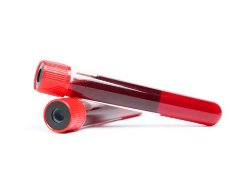 Liver Function Tests