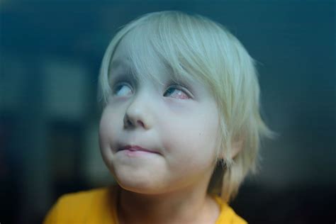 Tipos De Conjuntivitis Wikivision