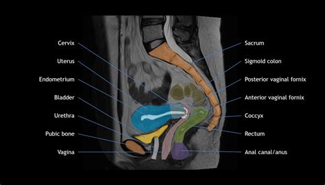 Normal Female Pelvic Mri