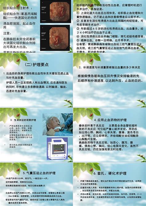 上消化道大出血及观察ppt模板卡卡办公