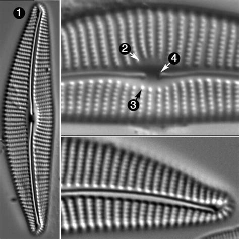 Cymbella Compacta Species Diatoms Of North America