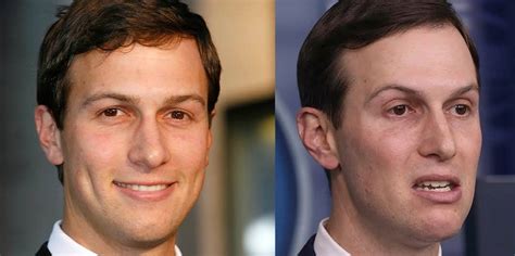 What Happened To Jared Kushners Face — Do Beforeafter Pics Show