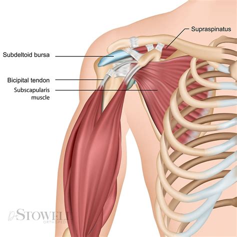 Supraspinatus Tendon Tear Treatment