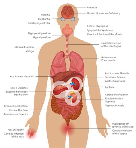 Ectodermal Dystrophy Asymptomatic Rash In A Male Infant With