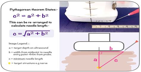 Esra19 0329 Use Of Pythagorean Theorem To Optimise Needle Length
