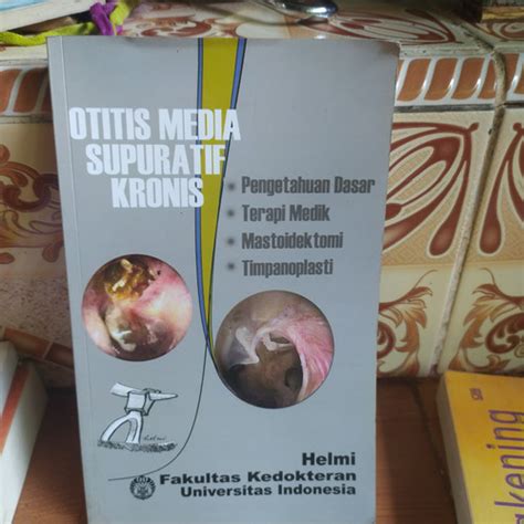 Jual Otitis Media Supuratif Kronis Pengetahuan Dasar Terapi Metrik